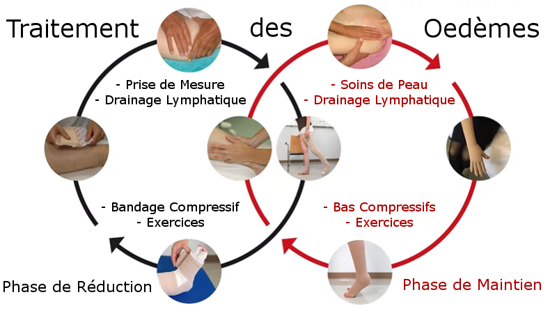 Massage et Drainage Lymphatique Manuel - Traitement des Oedèmes